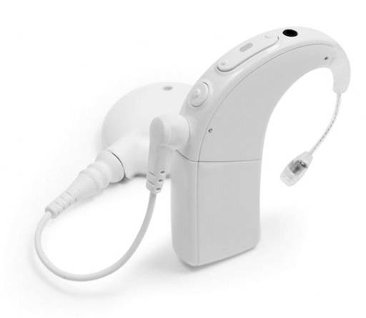 What is a Cochlear Implant? – YAIS