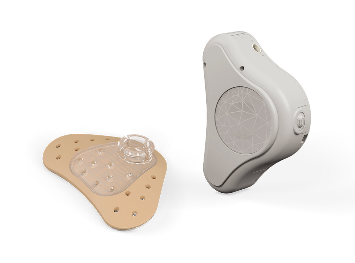 Temporary solutions – YAIS